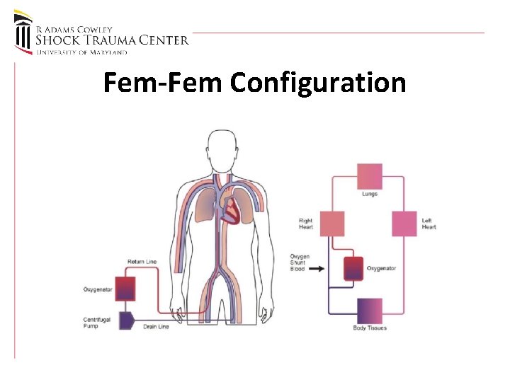 Physiology of VenoVenous ECMO Sam Galvagno D O