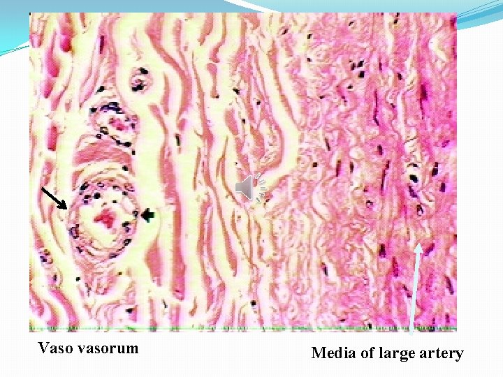 Prepared by Dr Esam Omar Components of vascular