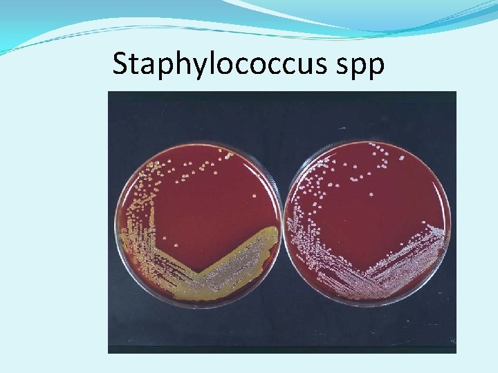 Practical of Urinary Tract Infection Department of Microbiology