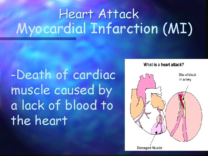 What you need to know about Heart Disease