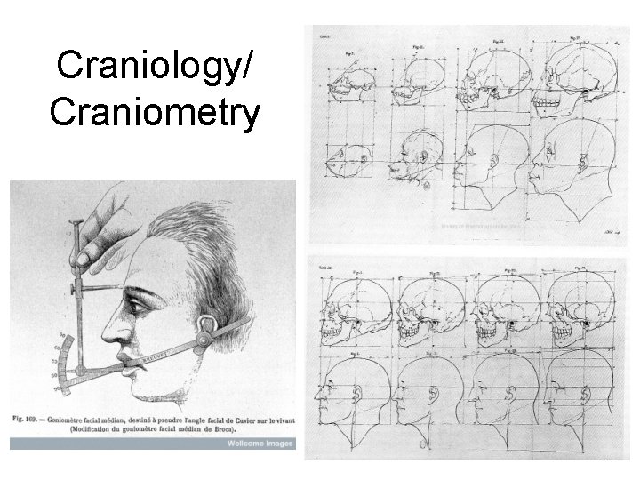 Myths and Measurements From Phrenology to Anthropometry HI