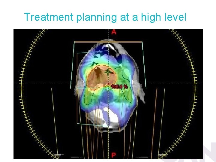 Artificial Intelligence in Radiation Oncology Marco Carlone Outline