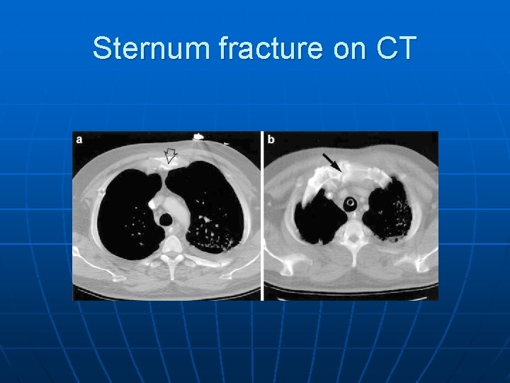 Anterior Chest Pain a musculoskeletal perspective Dr Shrenik