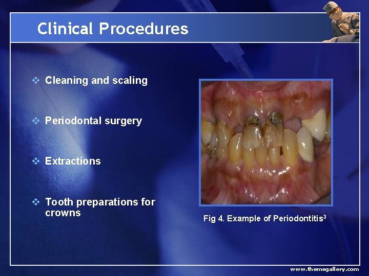 The fabrication of a maxillary and a mandibular