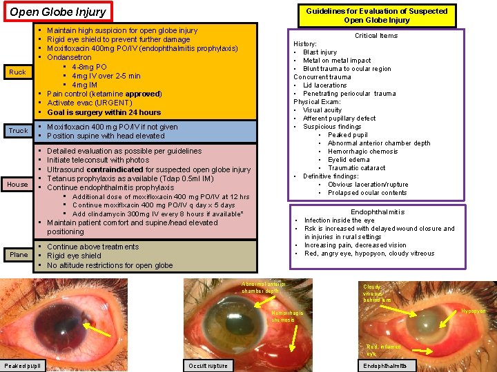Open Globe Injury Guidelines for Evaluation of Suspected