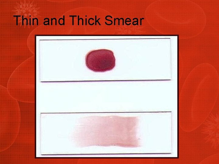 MALARIA PLASMODIUM Dr Amita Arya AP Microbiology Plasmodium