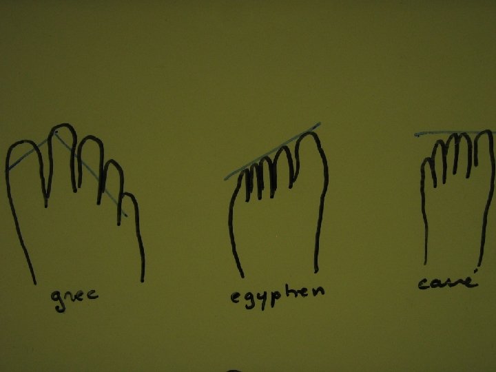 SEMIOLOGIE DU PIED Rappel anatomique Trois parties tarse