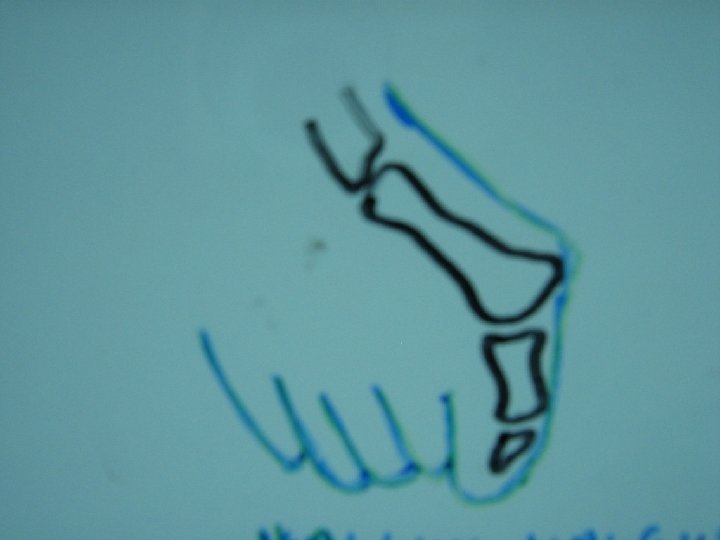 SEMIOLOGIE DU PIED Rappel anatomique Trois parties tarse