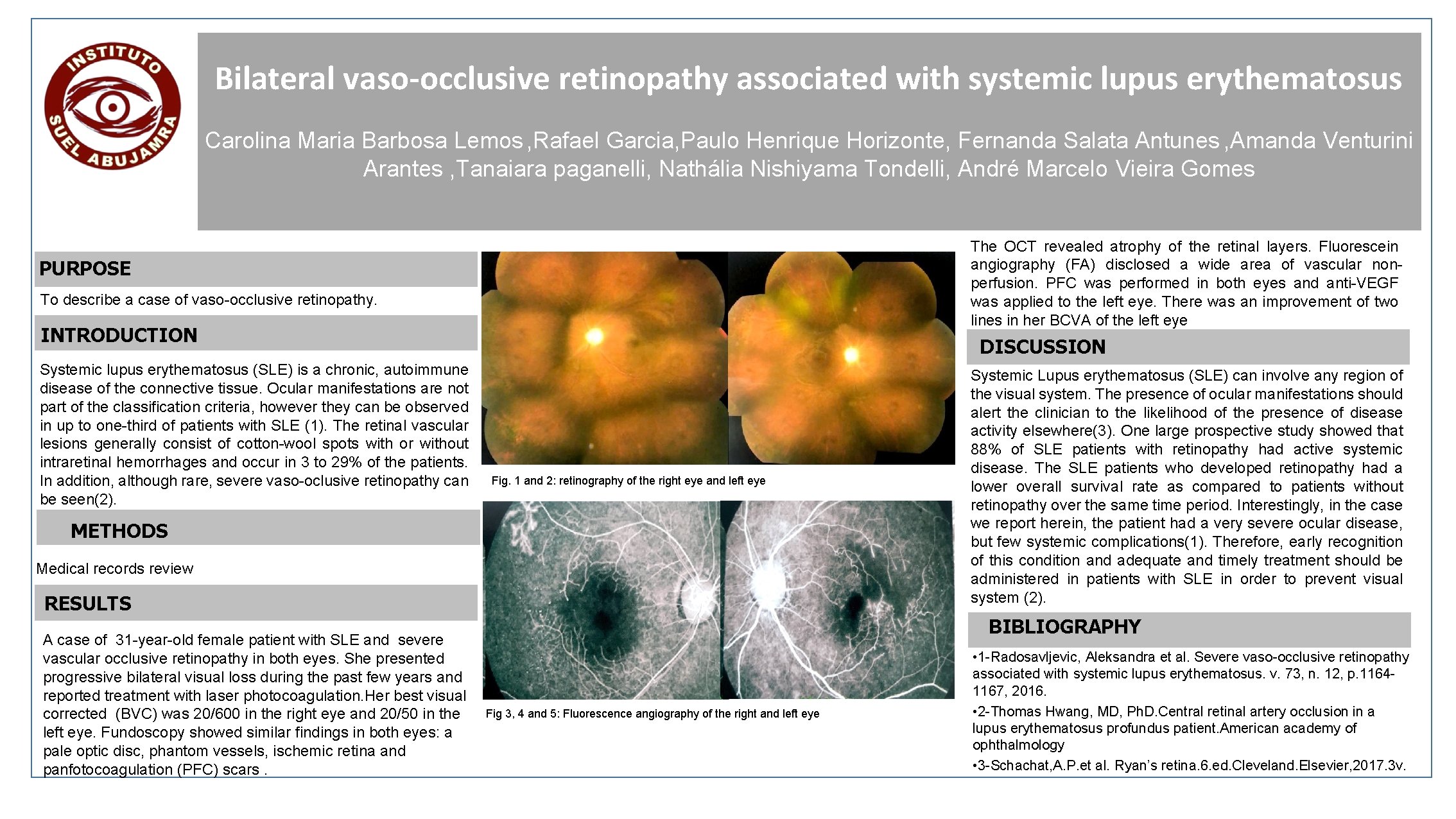 Bilateral vasoocclusive retinopathy associated with systemic lupus ...