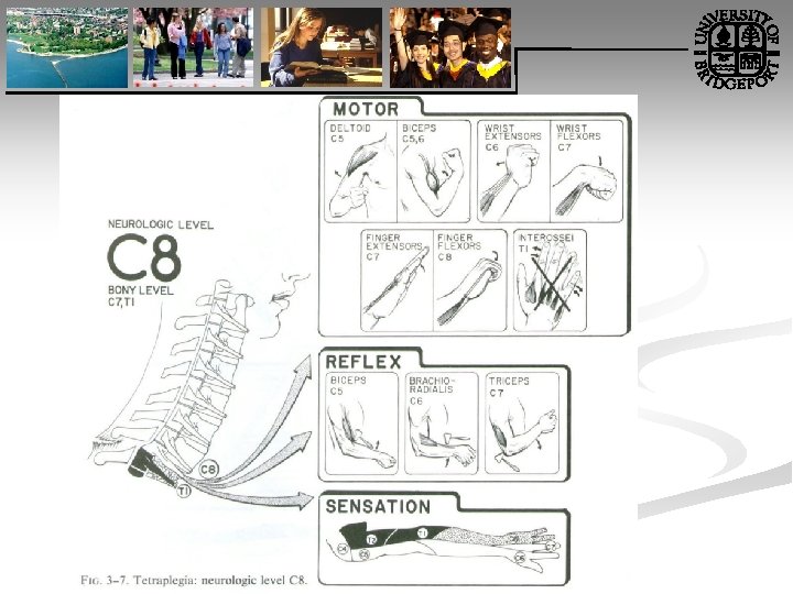 Orthopaedic Neurology Cervical Cord Lesions Tetraplegia Stanley Hoppenfeld