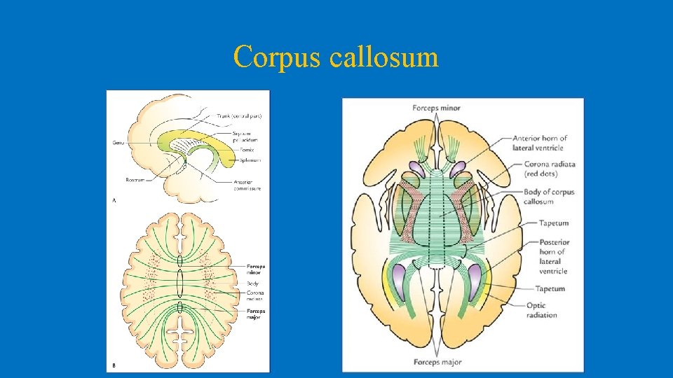 Hemispheres meninges lateral ventricles Dr Anna L Kiss