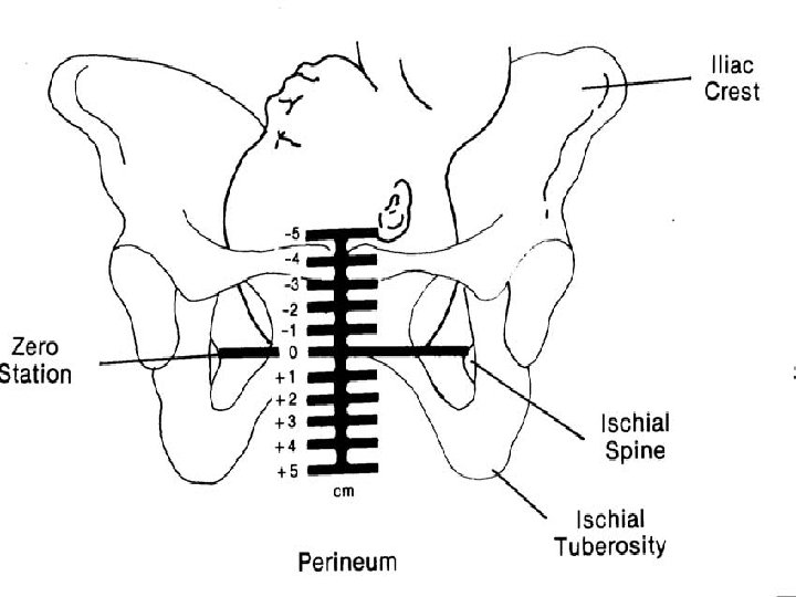 Labor and delivery Intrapartum Care Reproductive Health Nursing