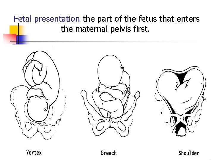 Labor and delivery Intrapartum Care Reproductive Health Nursing