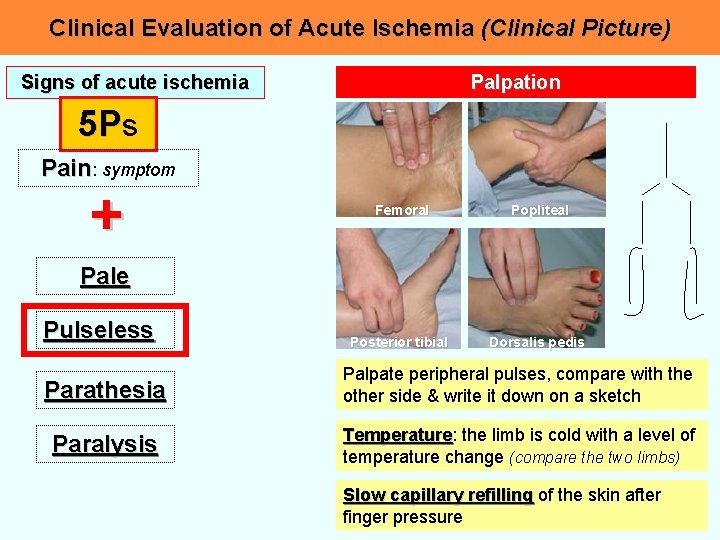 Acute Limb Ischemia Definition Etiology Patophysiology Clinical Evaluation