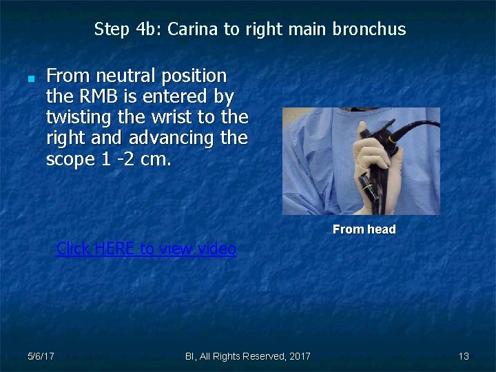 Step by Step Flexible Bronchoscopy StepbyStep Exercises to