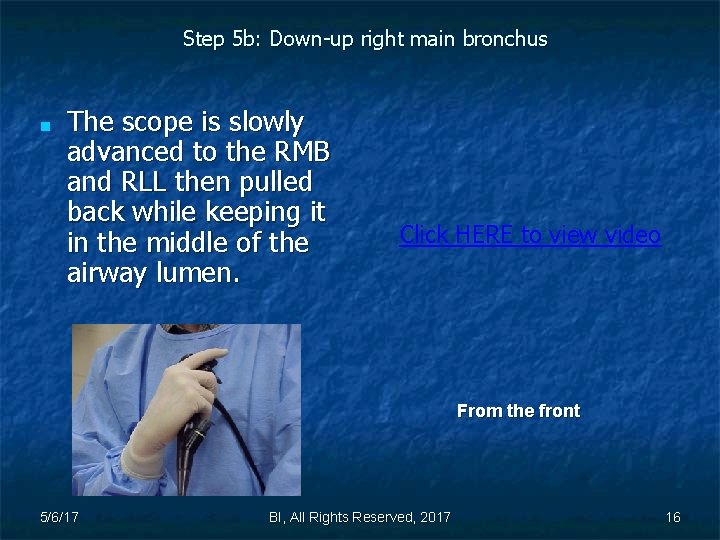 Step by Step Flexible Bronchoscopy StepbyStep Exercises to