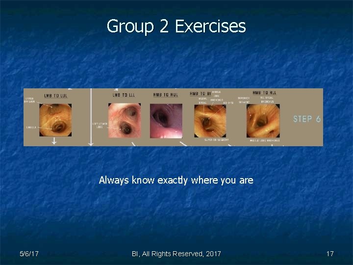 Step by Step Flexible Bronchoscopy StepbyStep Exercises to