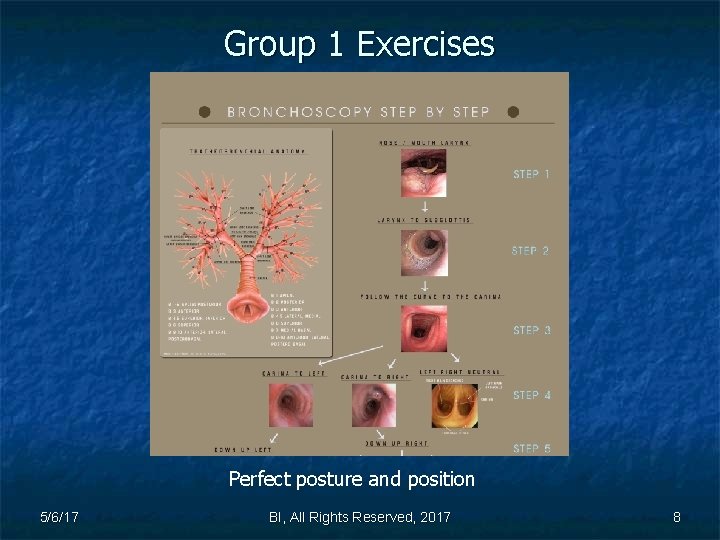 Step by Step Flexible Bronchoscopy StepbyStep Exercises to