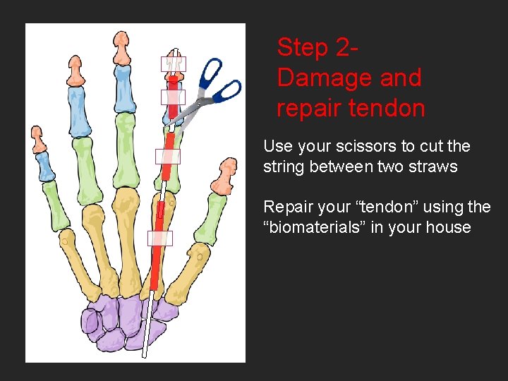 Introducing the MUSCULOSKELET AL System Any questions for