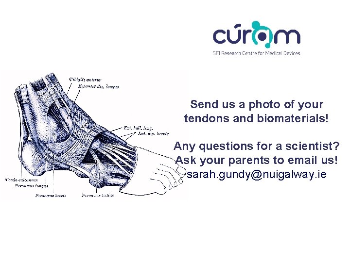 Introducing the MUSCULOSKELET AL System Any questions for
