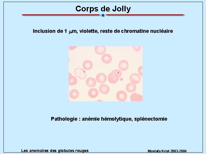 Les anomalies des globules rouges La forme et