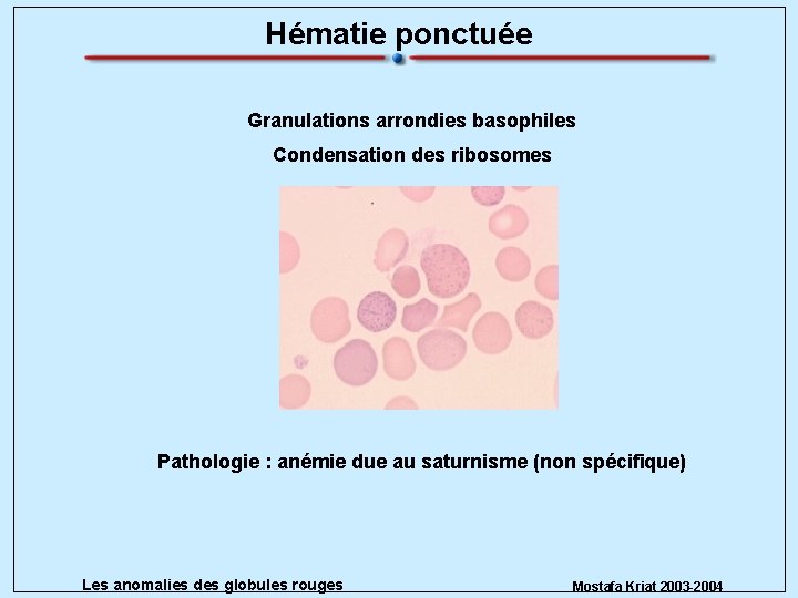 Les anomalies des globules rouges La forme et