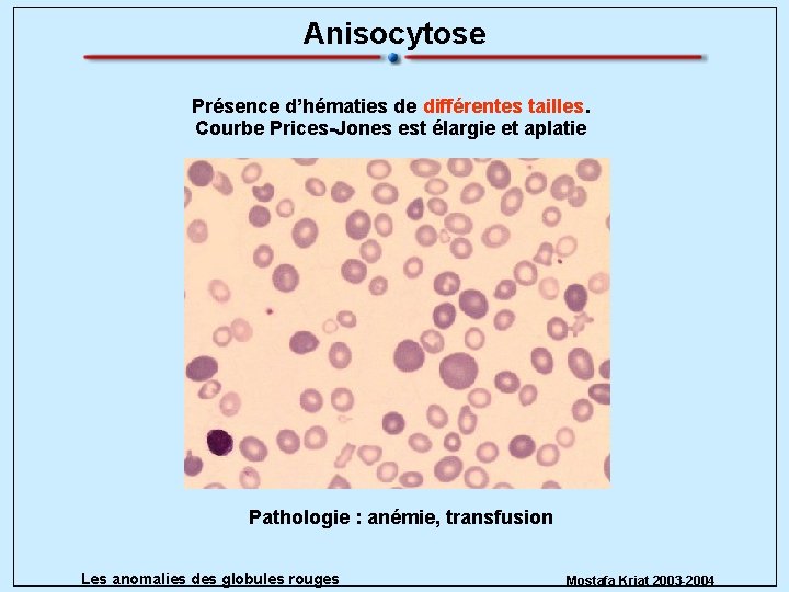 Les anomalies des globules rouges La forme et