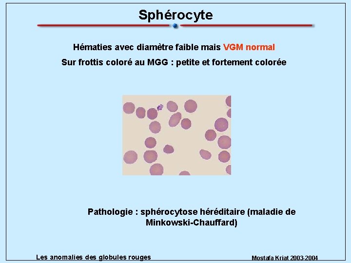 Les anomalies des globules rouges La forme et