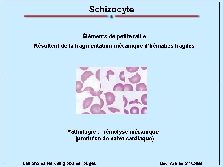 Les anomalies des globules rouges La forme et