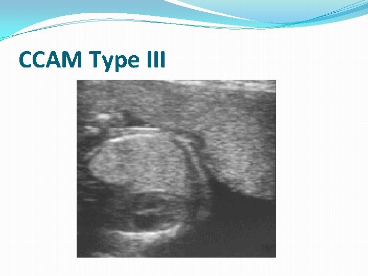 Diagnostic Medical Sonography Program Obstetrical Sonography Part I