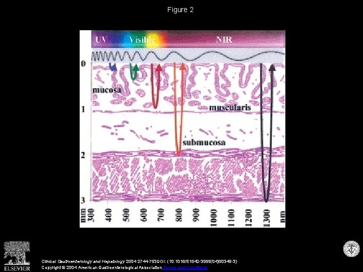 Optical biopsy A new frontier in endoscopic detection