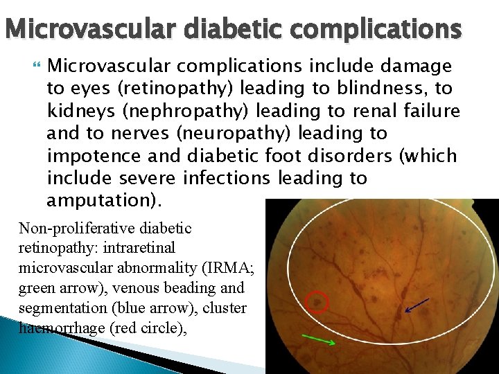 Vascular Diseases Chronic elevation of blood glucose levels