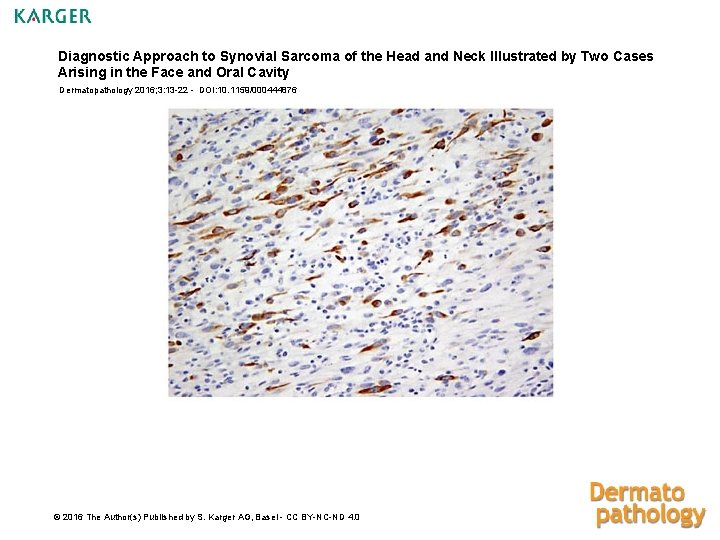 Diagnostic Approach to Synovial Sarcoma of the Head
