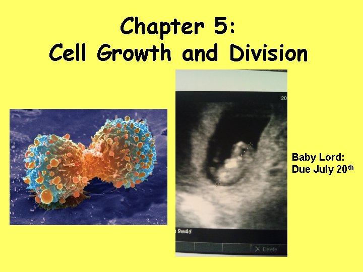Chapter 5 Cell Growth and Division Baby Lord