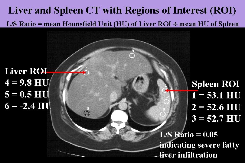 Diabetes and Obesity and Aging 20 of men