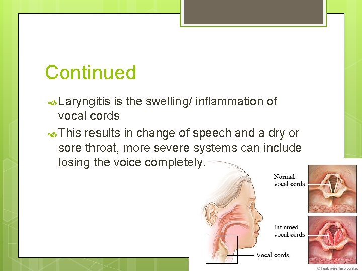 Larynx Brendon Degner Introduction The Larynx is located
