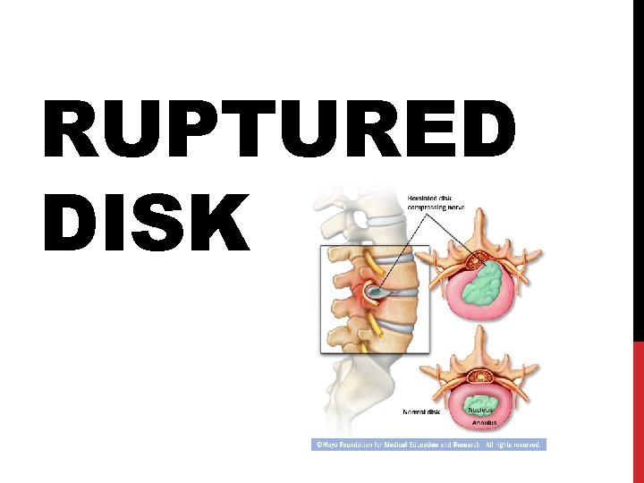 Skeletal System Disorders and Diseases Created by HS