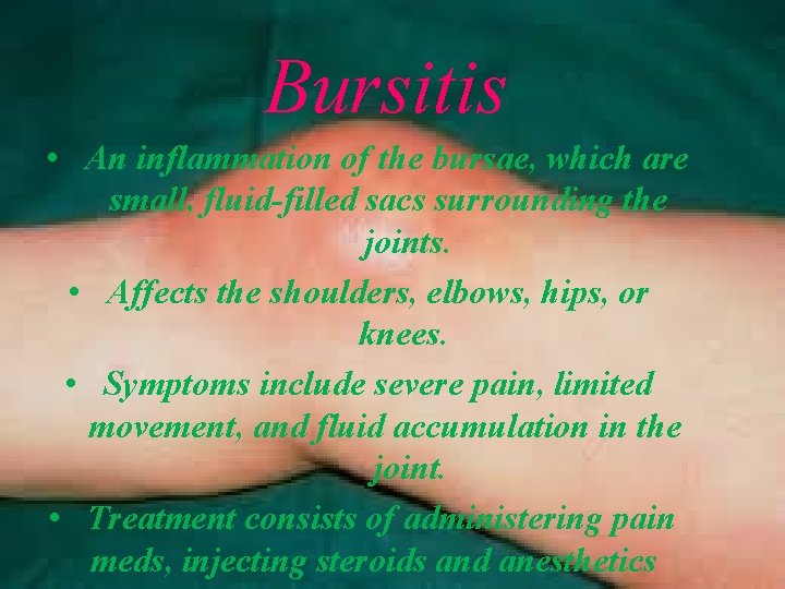 Skeletal System Disorders and Diseases Created by HS