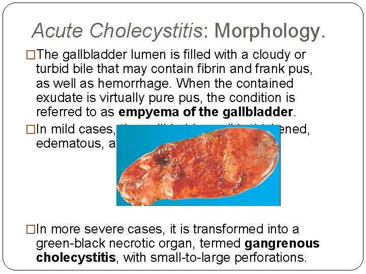 PATHOLOGY AND PATHOGENESIS OF CHOLECYSTITIS Pathology and pathogegenesis