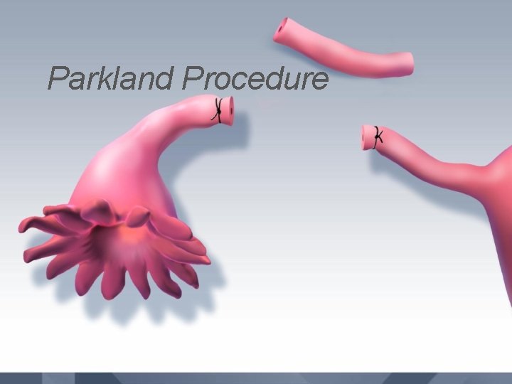 Permanent contraception EVE ESPEY MD MPH OBSTETRICS GYNECOLOGY