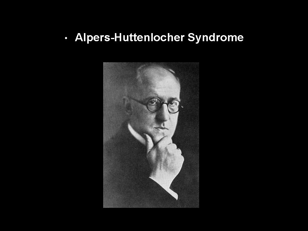AlpersHuttenlocher Syndrome POLG Aaron Burd AlpersHuttenlocher Syndrome ...