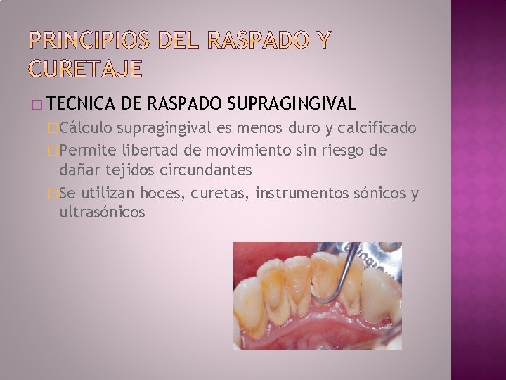 UNIDAD III INSTRUMENTACIN PERIODONTAL PRINCIPIOS DE LA INSTRUMENTACIN