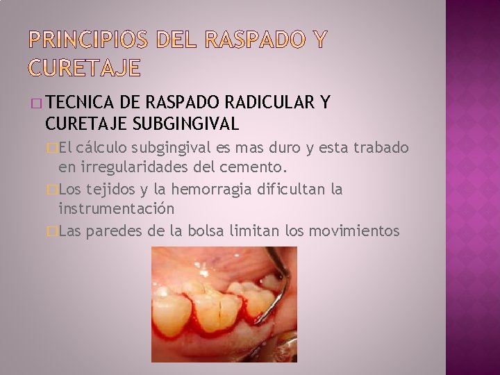 UNIDAD III INSTRUMENTACIN PERIODONTAL PRINCIPIOS DE LA INSTRUMENTACIN
