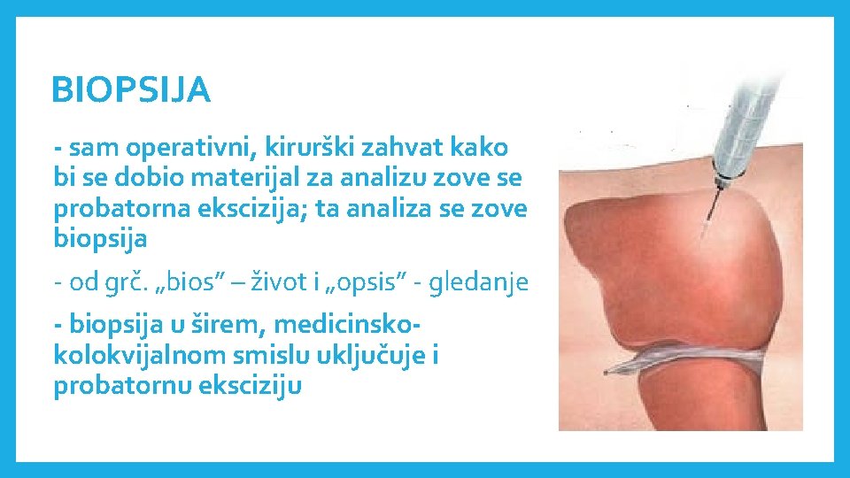 3 BIOPSIJA PUNKCIJA I ASPIRACIJA Medicinska kola u