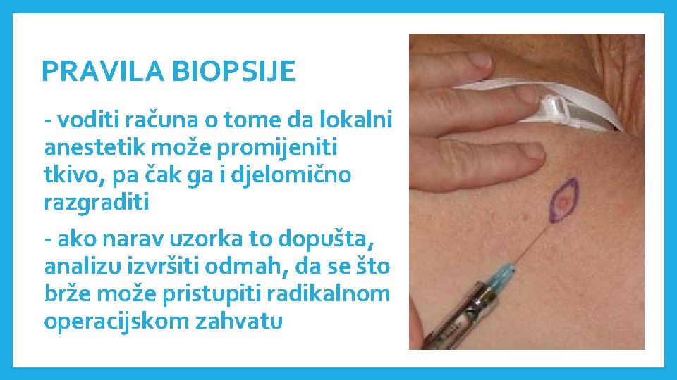 3 BIOPSIJA PUNKCIJA I ASPIRACIJA Medicinska kola u