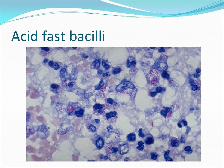 Clinical Microbiology Laboratory the place and the contribution