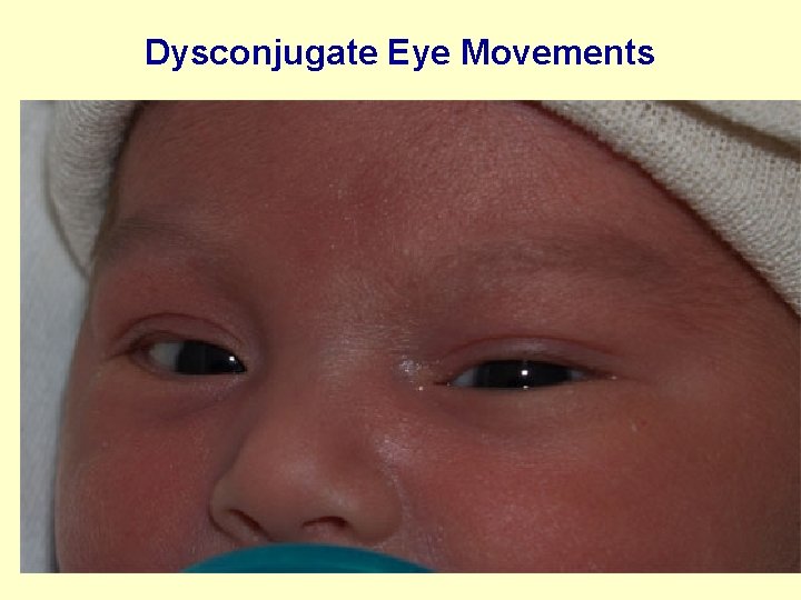 Normal Newborn care Neonatal care Islamic University Nursing