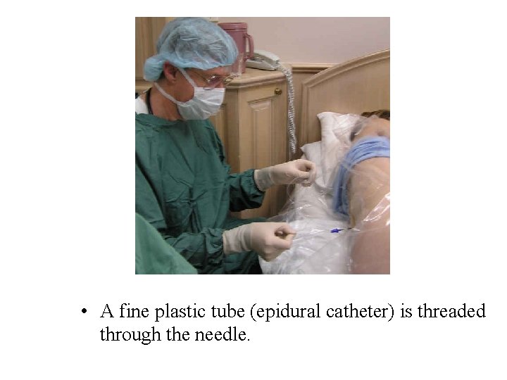 Insertion of Epidural in Labour This slide show