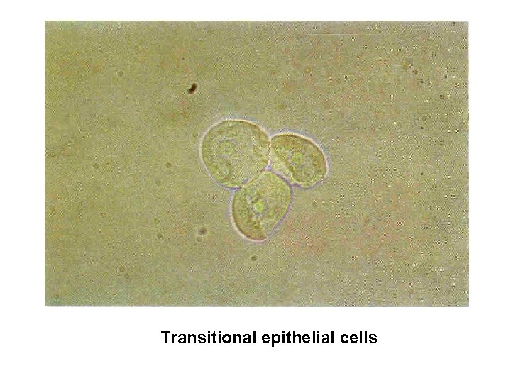 PEMERIKSAAN LABORATORIUM KELAINAN UROGENITAL Efrida dr Sp PK