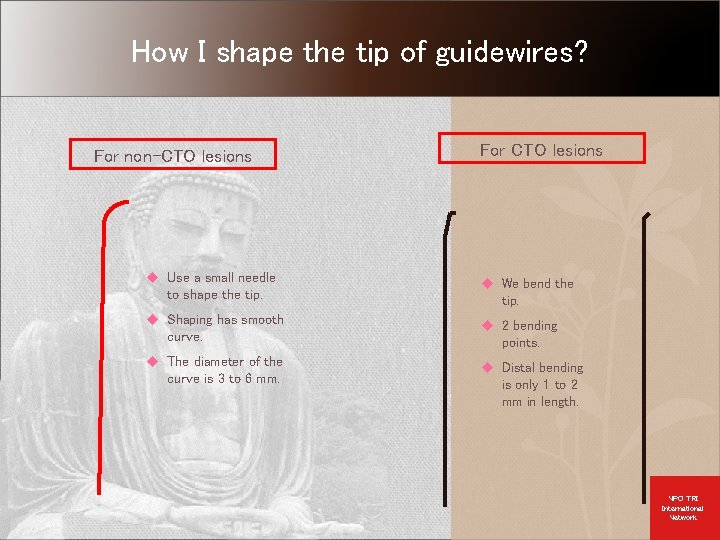 Antegrade Guidewire Basics Guidewire Tip Shaping Escalation Strategies